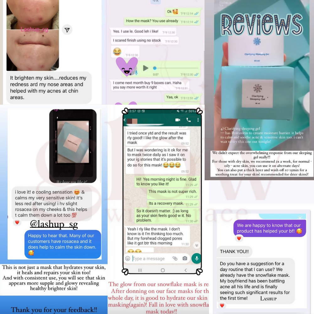 Snowflake Skin – GlowWithGrace